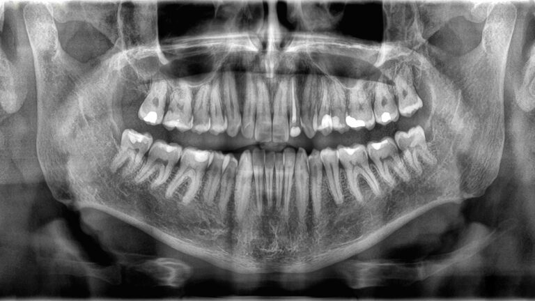 Pourquoi les dents ne comptent-elles pas comme des os ? - Reveil ...